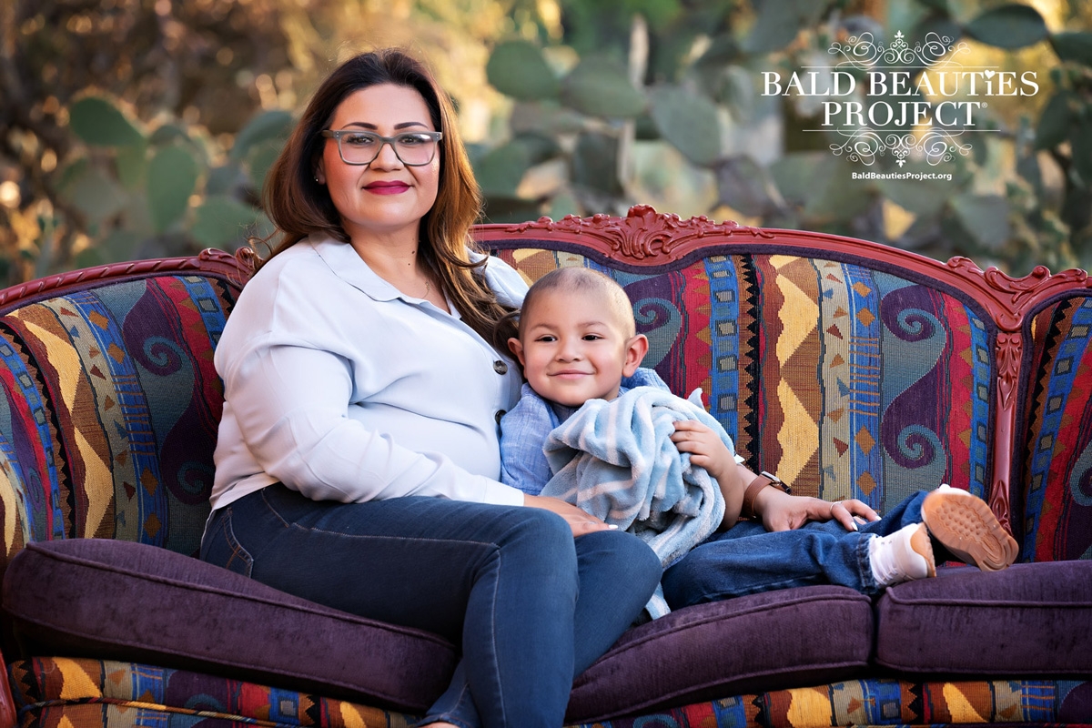 Gabriel – Bald Beauties Project®