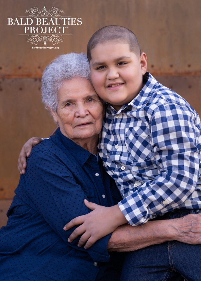 Miguel – Bald Beauties Project®